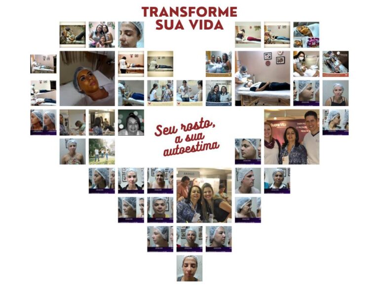 O guia completo dos cuidados pós microagulhamento em Brasília para uma ...