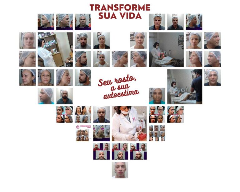 O guia completo dos cuidados pós microagulhamento em Brasília para uma ...