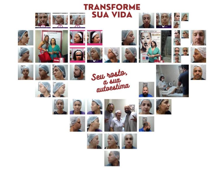 O guia completo dos cuidados pós microagulhamento em Brasília para uma ...