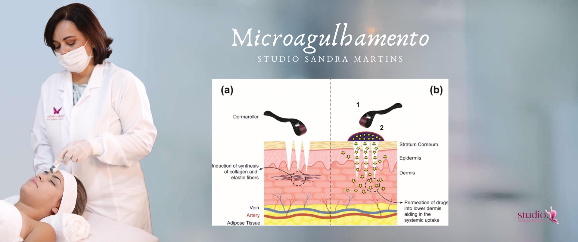 Recupere a autoestima com o poder do microagulhamento em Brazlândia ...
